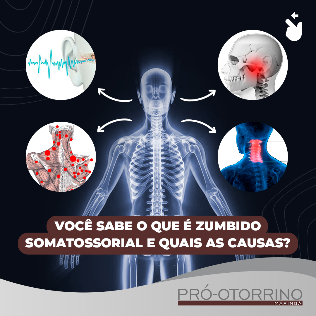 Você sabe o que é zumbido somatossorial e quais as causas? 🤔👇🏻 - Pró ...